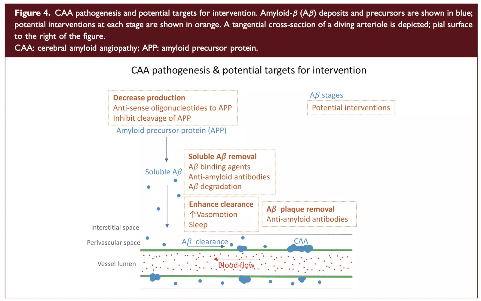 Angiopatia Amilóide – neurosky