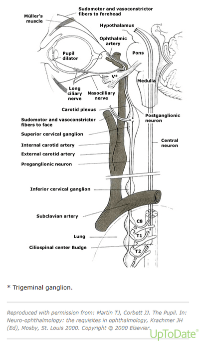 SkySemiology #13 - Síndrome de Horner – neurosky