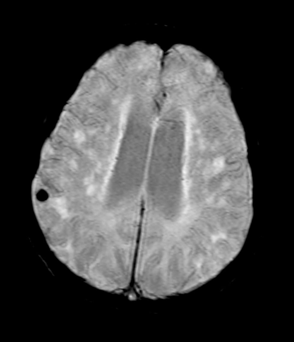 SWI Conceitos Básicos – neurosky